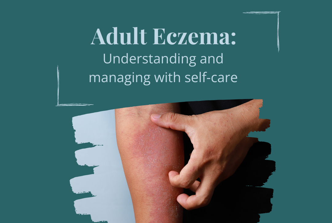 Adult Eczema: Understanding and Managing with Self-care | See All ...